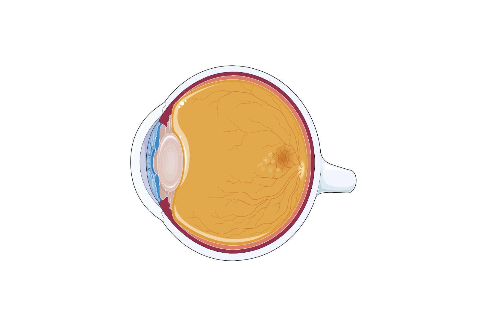 Nevrita optică sau inflamația nervului optic: simptome și tratament